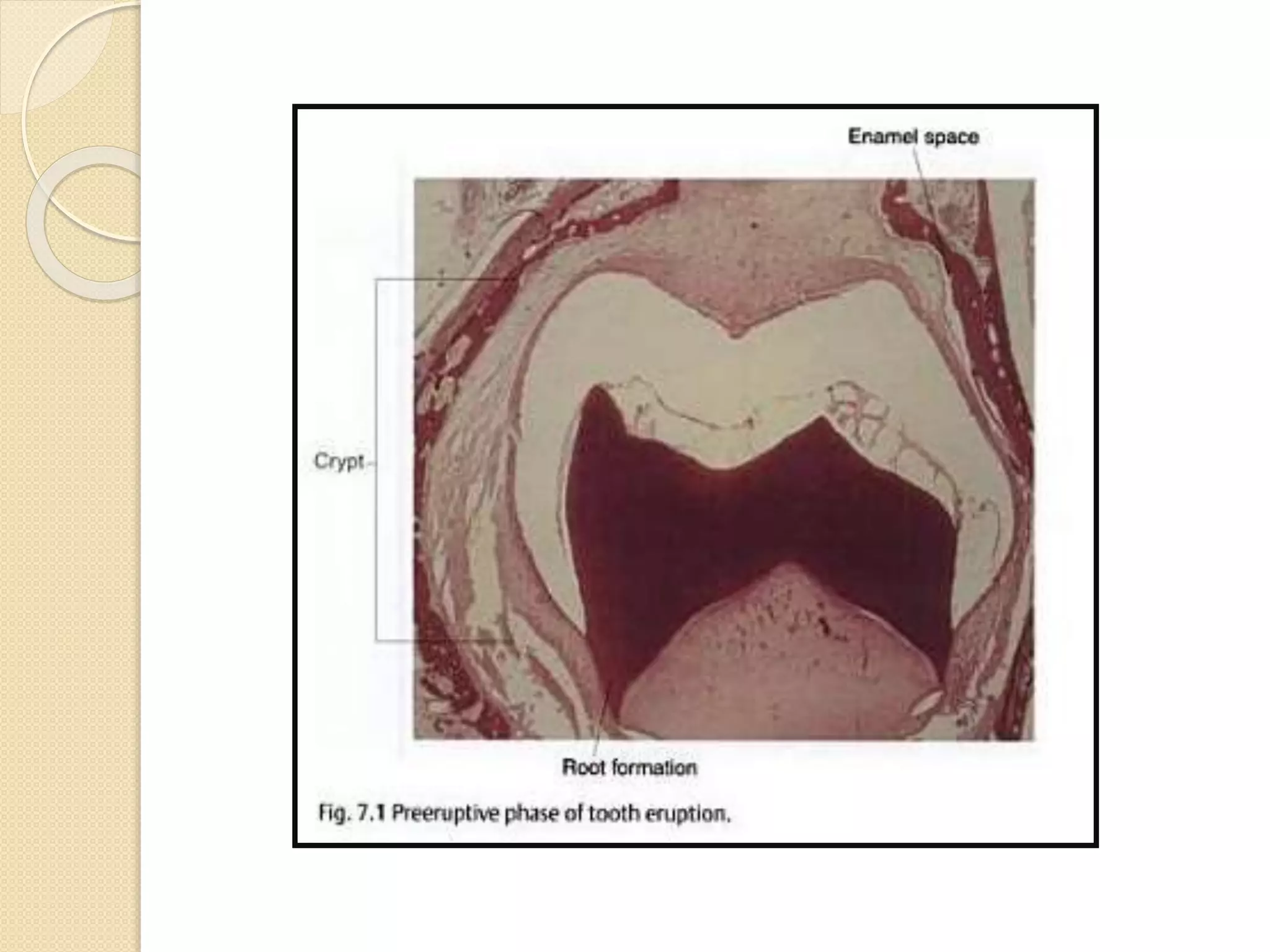 Tooth eruption | PPTX