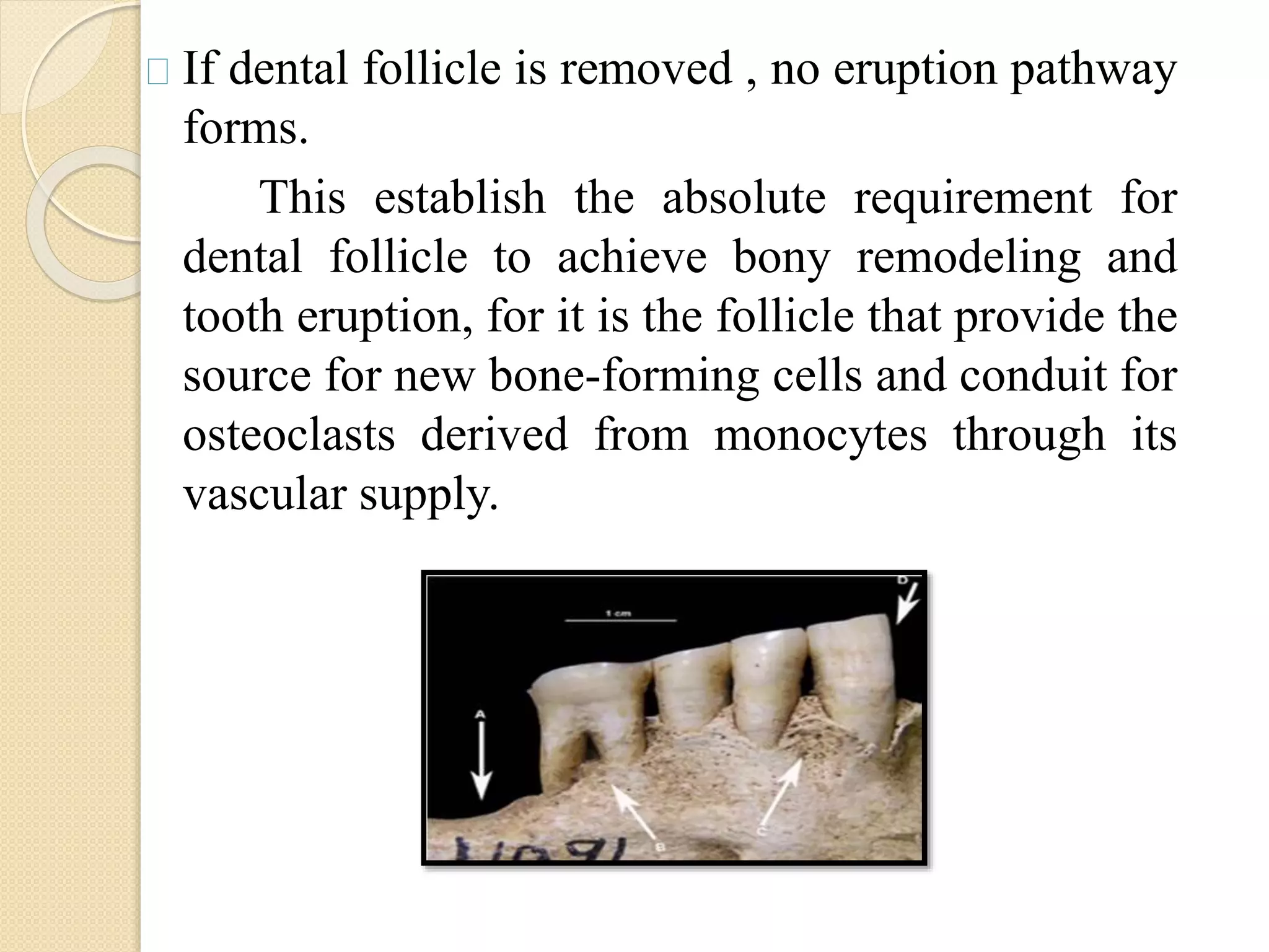 Tooth eruption | PPTX | Dental Health | Diseases and Conditions