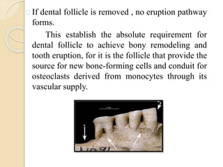 Tooth eruption | PPTX