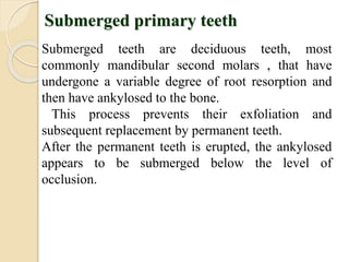Tooth eruption | PPT