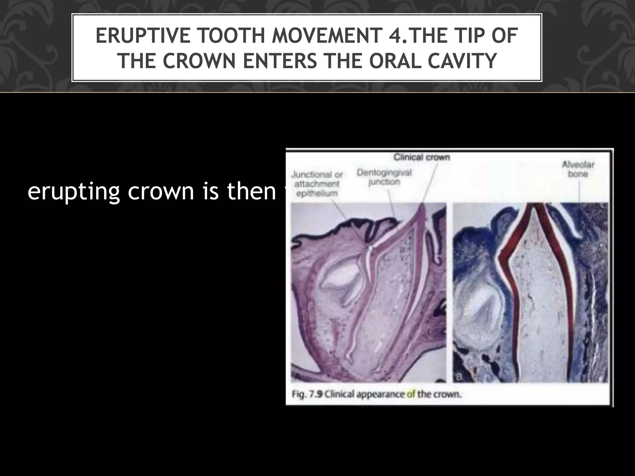 Tooth eruption | PPTX