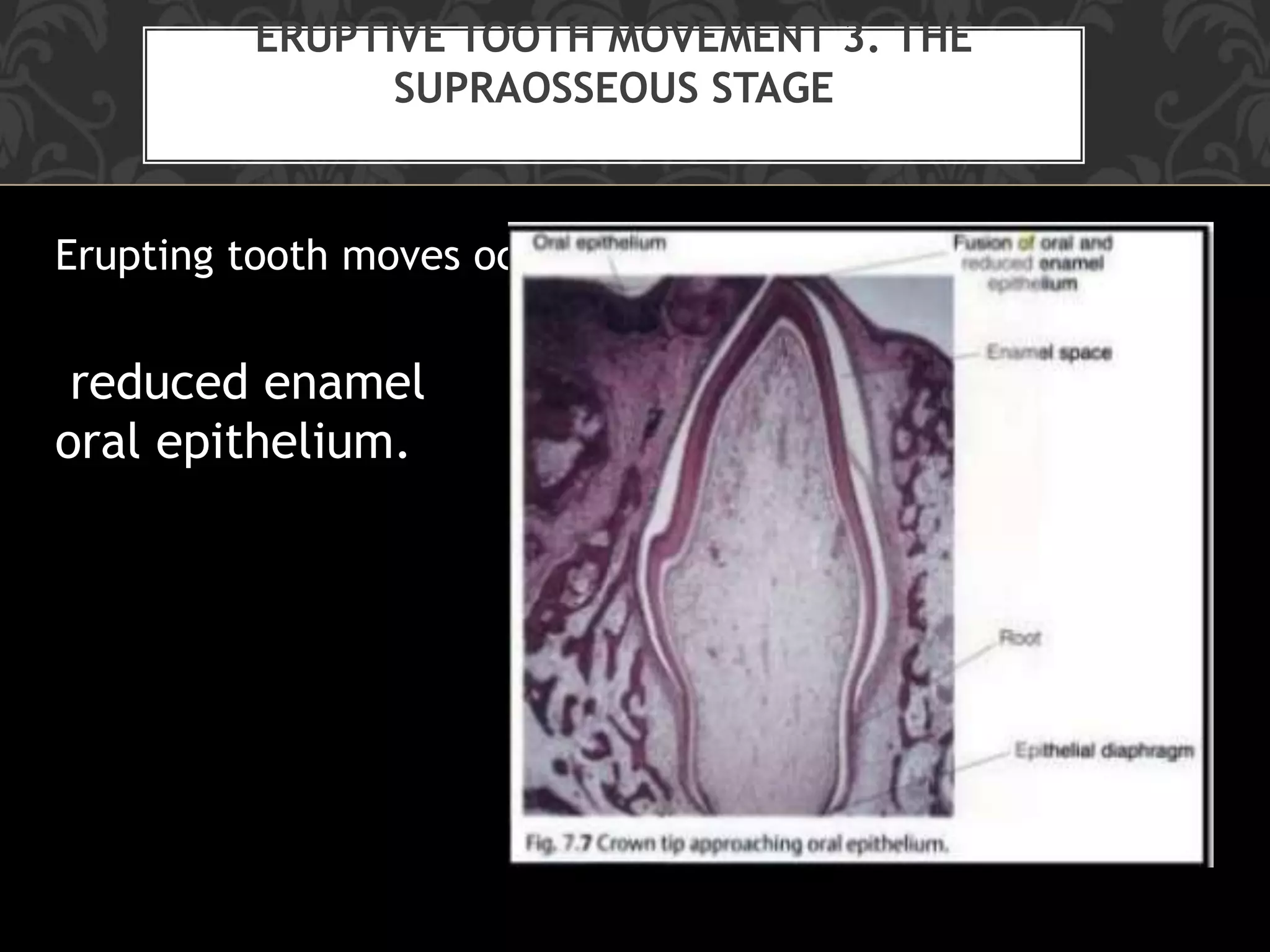 Tooth eruption | PPTX