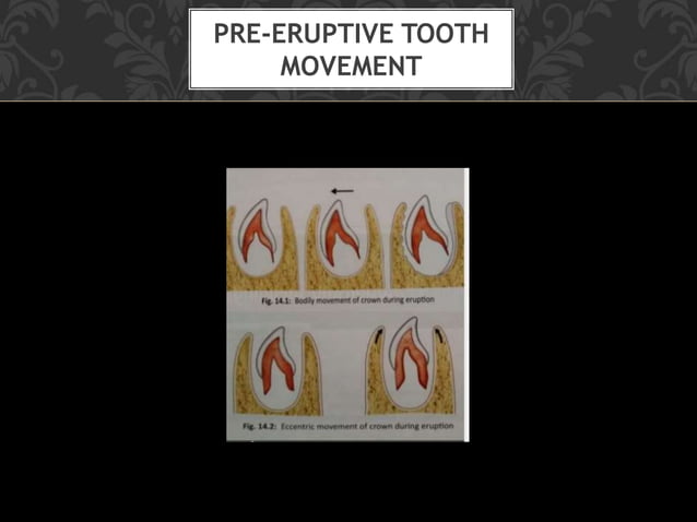 Tooth eruption | PPT