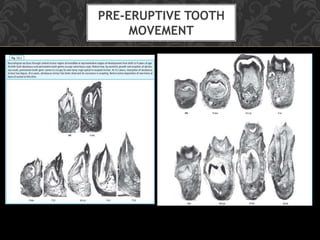 Tooth eruption | PPTX