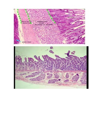 Tooth, esophagus, stomach, small intestine | DOC
