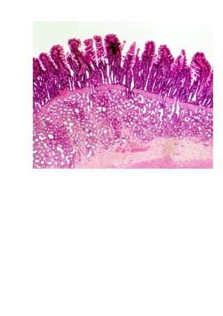 Tooth, esophagus, stomach, small intestine | PDF