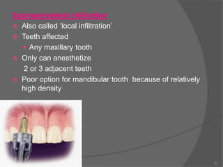 Tooth Extraction Ngoma.pdf