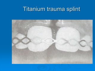Tooth Fracture Treatment | PPT