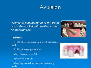 Tooth Fracture Treatment | PPT