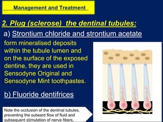 Tooth hypersensitivity | PPTX