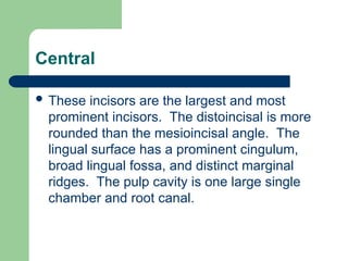 Tooth Identification GENERAL RULES DENT.ppt