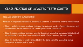 Tooth impaction | PPT