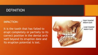 Tooth impaction | PPTX