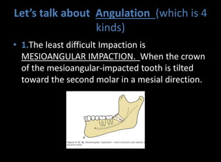 Tooth impaction | PPTX