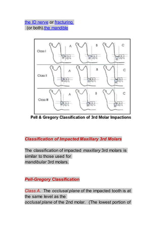 Tooth impaction seminar | DOCX | Dental Health | Diseases and Conditions