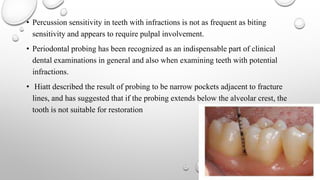 Tooth infarction | PPTX