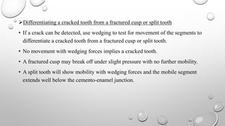 Tooth infarction | PPTX
