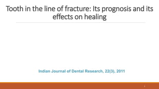 Journal Club on Tooth in the line of fracture its prognosis and its ...