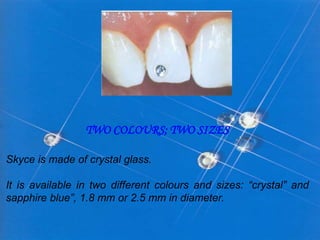 Tooth Jewellery in Delhi | PPT