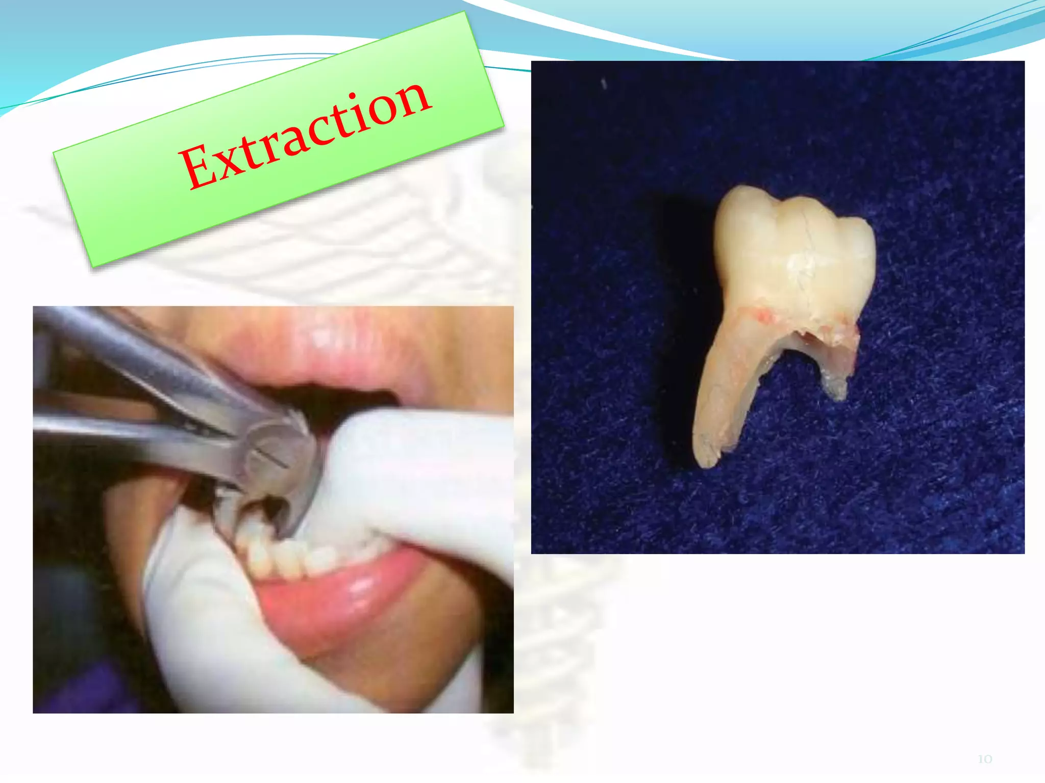 Tooth morphology...the architecture of god | PPTX