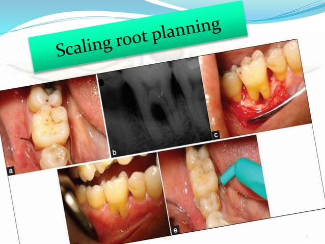 Tooth morphology...the architecture of god | PPT