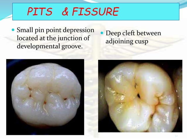Tooth morphology...the architecture of god | PPT