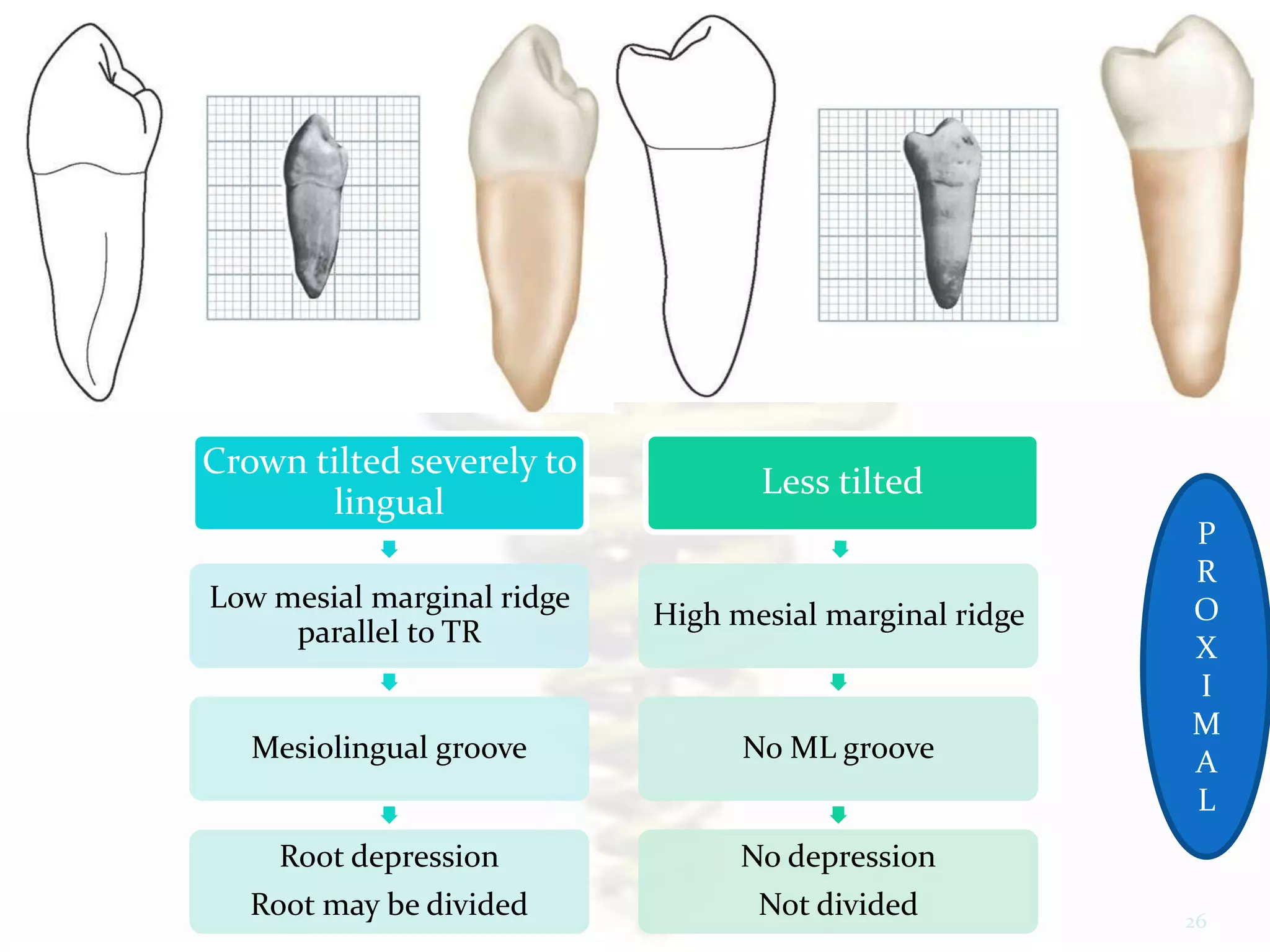 Tooth morphology...the architecture of part 3.....premolar and molar | PPTX