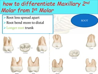 Tooth morphology...the architecture of part 3.....premolar and molar | PPTX