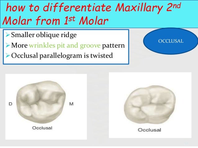 Tooth morphology...the architecture of part 3.....premolar and molar