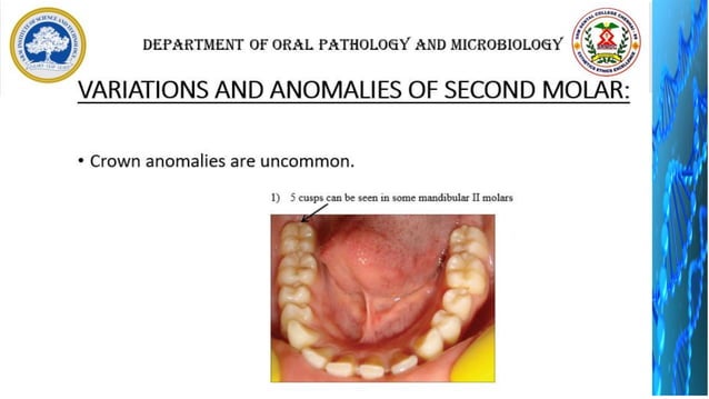 Tooth morphology-Permanent mandibular second molar - Divya B | PPT