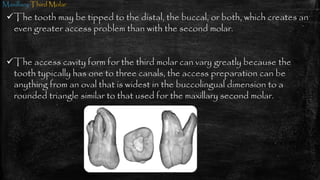Tooth Morphology And Access Cavity Preparation.pdf