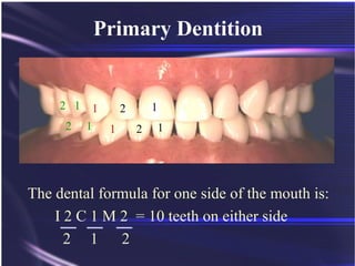 Dental Anatomy and landmarks of different teeth | PPTX