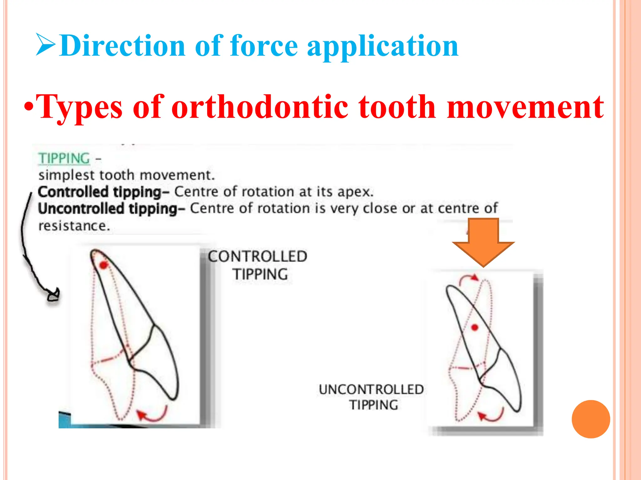Tooth movement in orthodontics how and why | PPTX | Dental Health | Diseases and Conditions