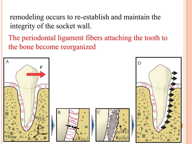 Tooth movement in orthodontics how and why | PPTX | Dental Health ...