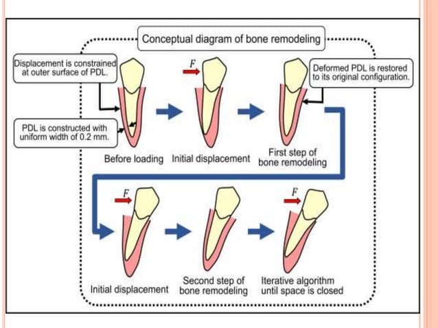 Tooth movement in orthodontics how and why | PPTX | Dental Health ...