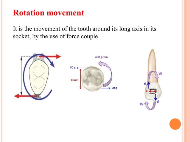 Tooth movement in orthodontics how and why | PPTX | Dental Health ...