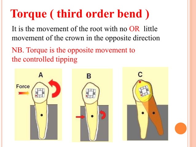 Tooth movement in orthodontics how and why | PPTX | Dental Health ...