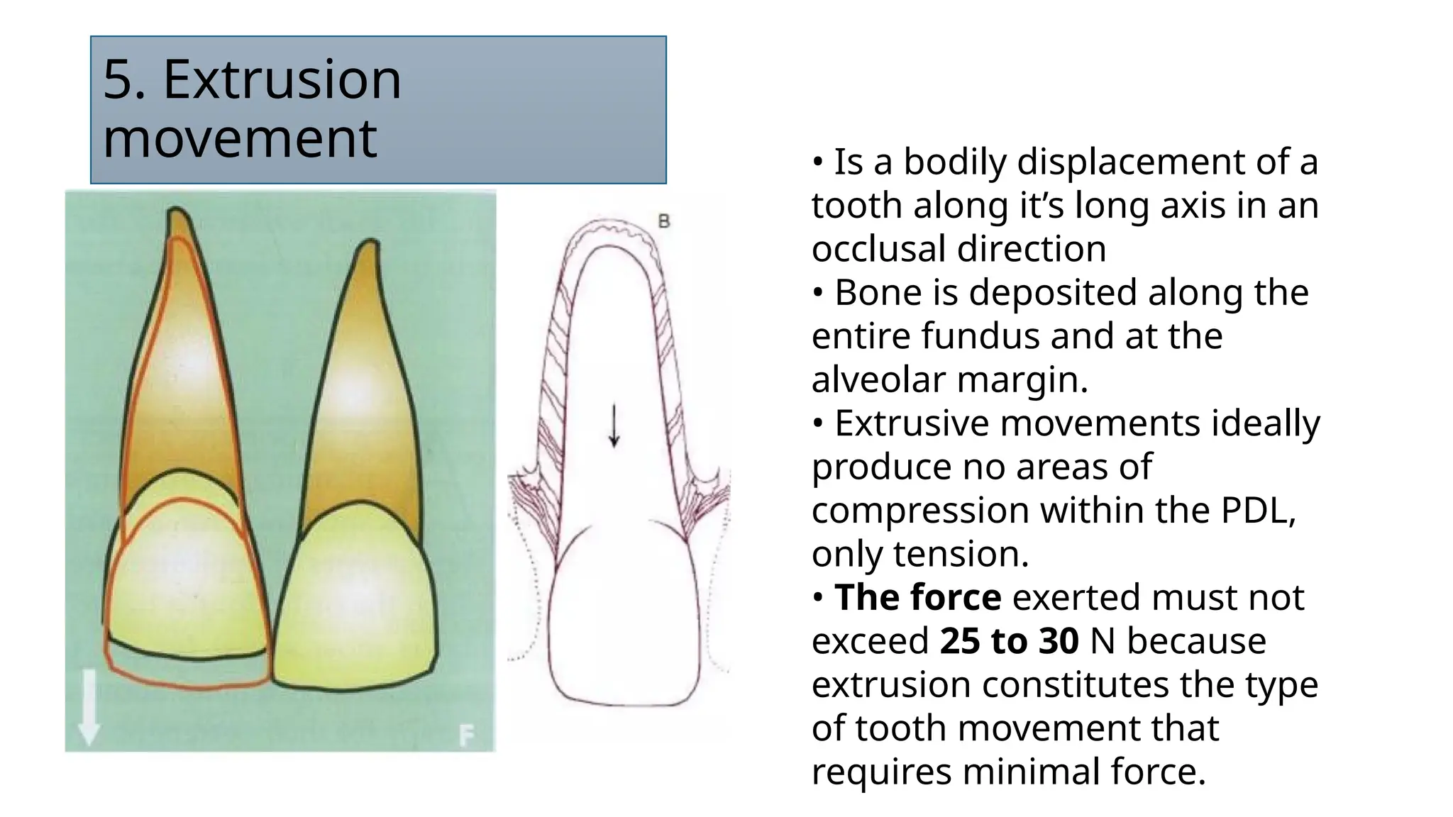 Theories and types of tooth movement .pptx