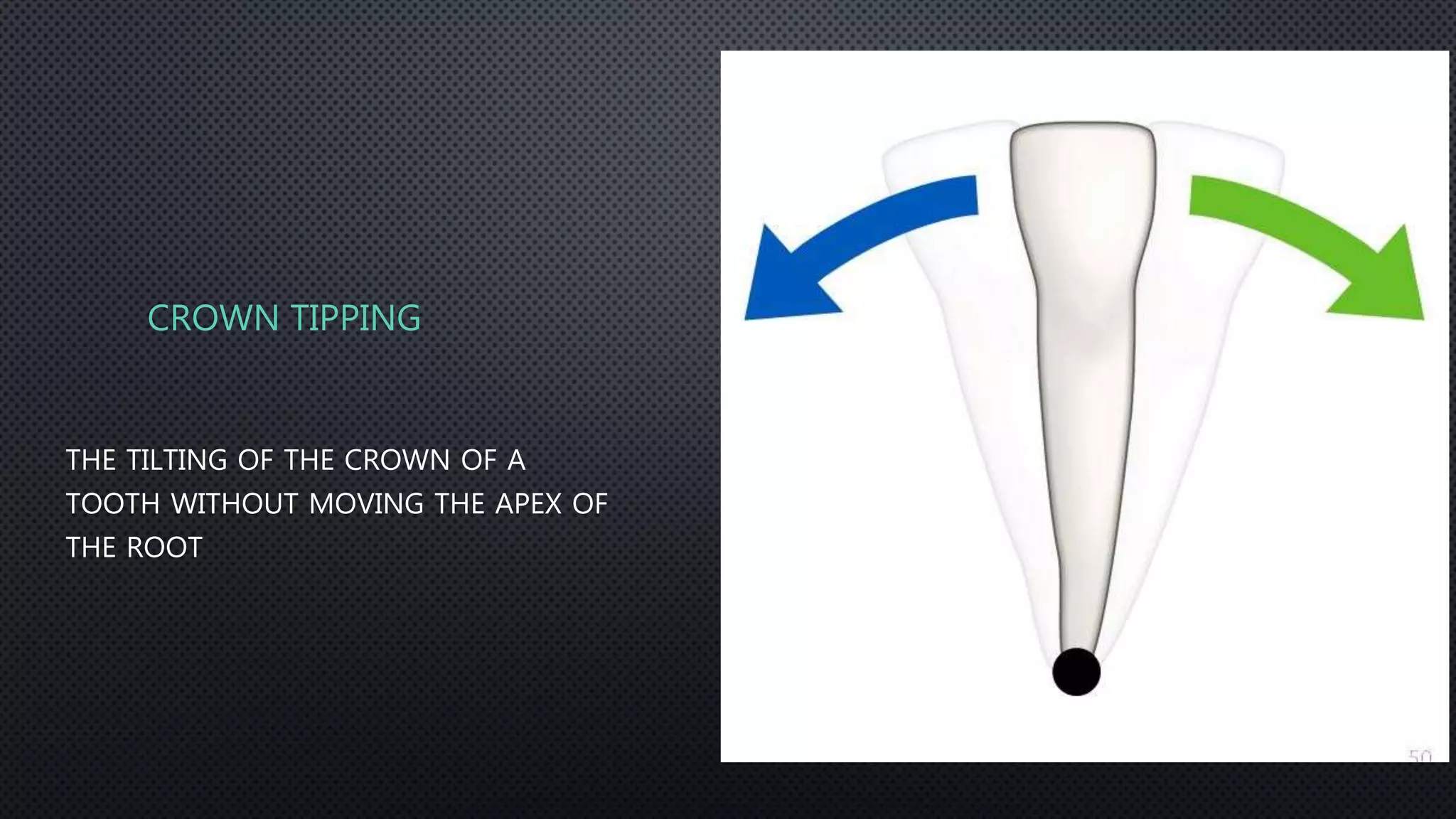 Orthodontic Tooth movement types | PPTX