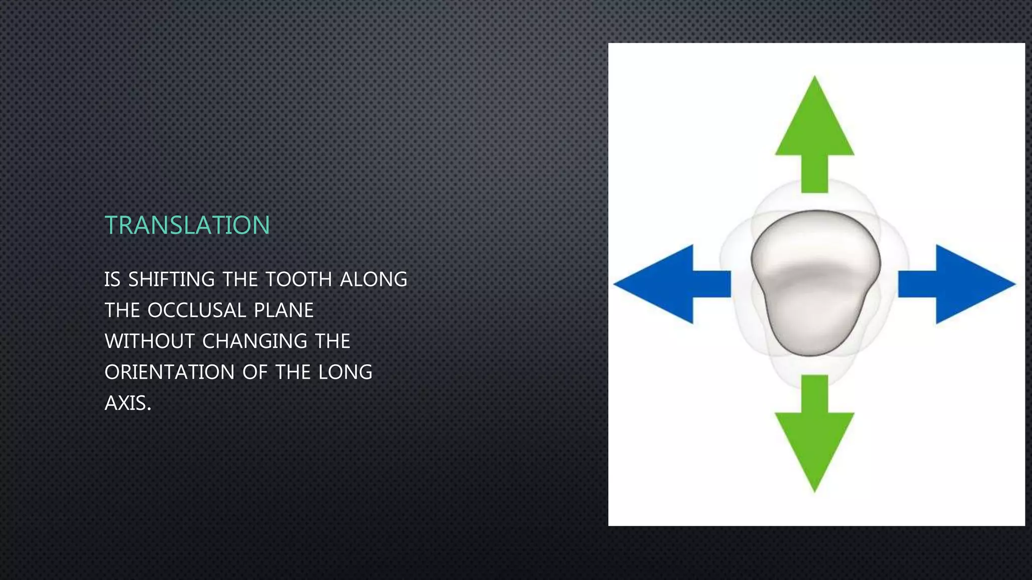 Orthodontic Tooth movement types | PPTX
