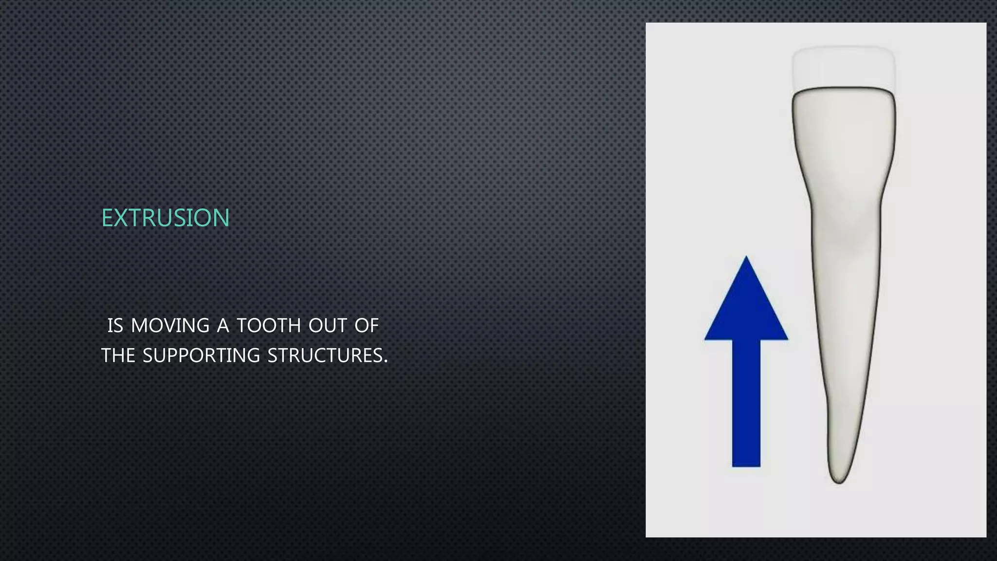 Orthodontic Tooth movement types | PPTX | Dental Health | Diseases and ...