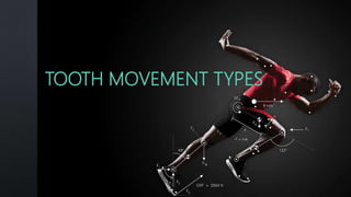 Orthodontic Tooth movement types | PPTX | Dental Health | Diseases and ...