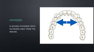 Orthodontic Tooth movement types | PPTX | Dental Health | Diseases and ...