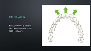 Orthodontic Tooth movement types | PPTX | Dental Health | Diseases and ...