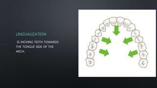 Orthodontic Tooth movement types | PPTX | Dental Health | Diseases and ...