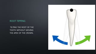 Orthodontic Tooth movement types | PPTX | Dental Health | Diseases and ...
