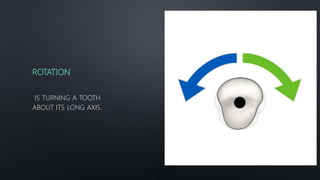 Orthodontic Tooth movement types | PPTX | Dental Health | Diseases and ...