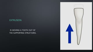 Orthodontic Tooth movement types | PPTX | Dental Health | Diseases and ...