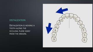 Orthodontic Tooth movement types | PPTX | Dental Health | Diseases and ...