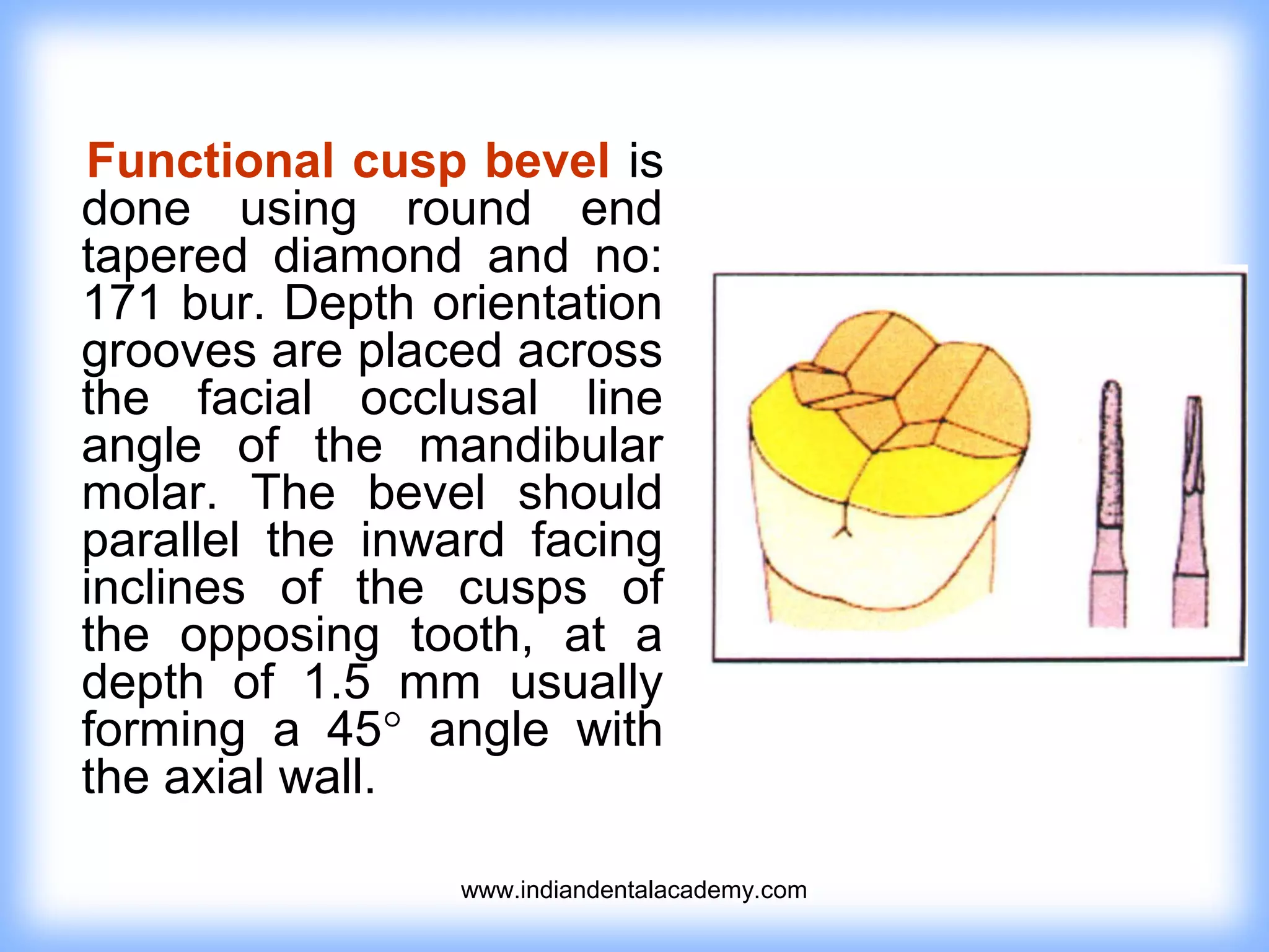 Tooth preparation for full veneer crowns /certified fixed orthodontic ...